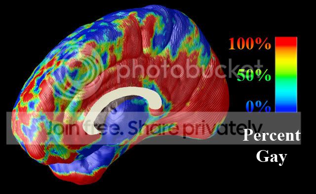 FARK.com: (3529552) Photoshop this brain scan of a meth addict